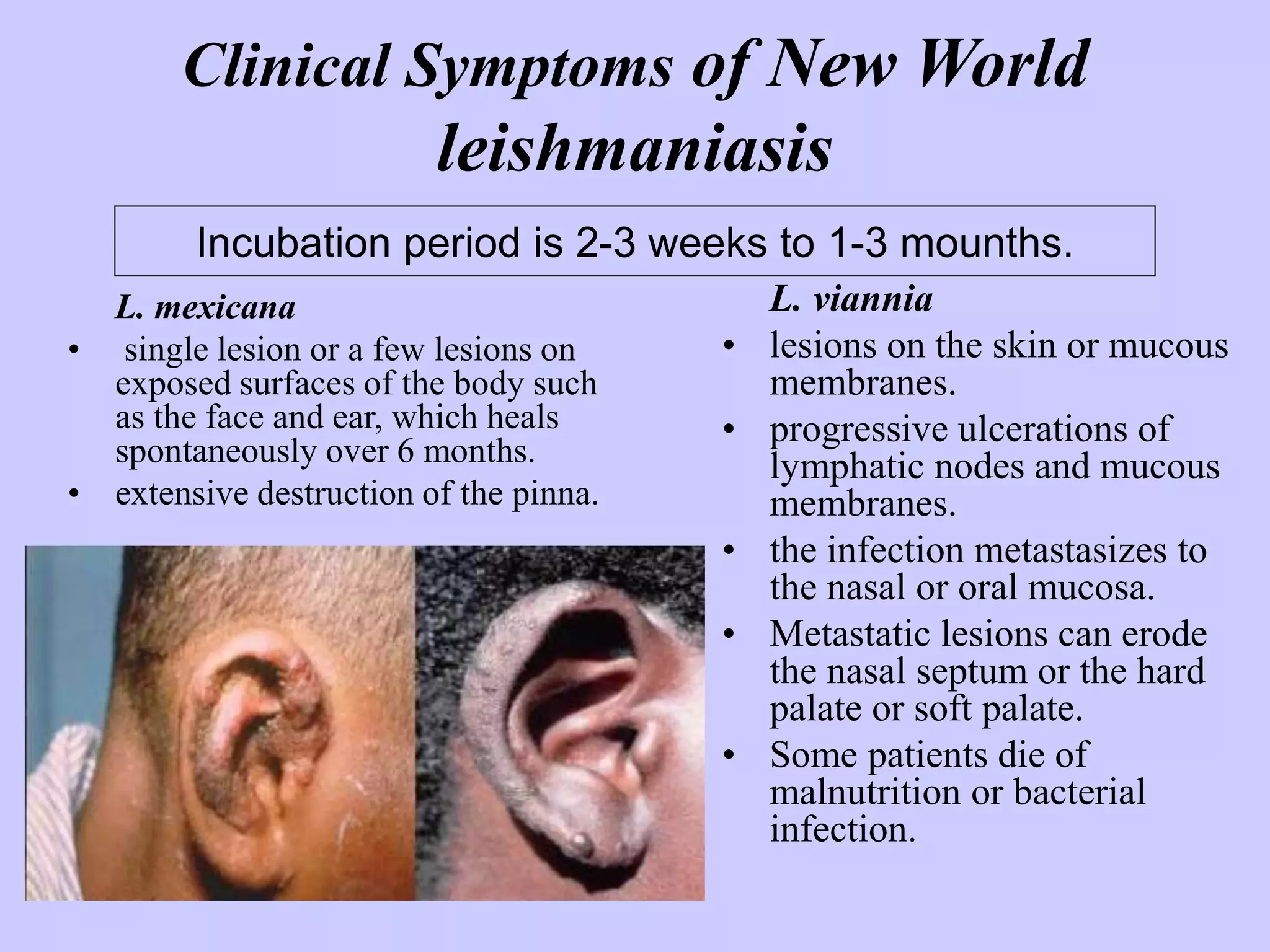 Leishmaniasis.ppt