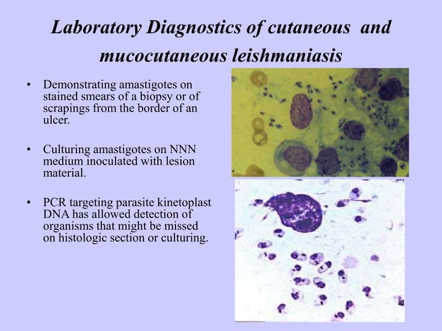 Leishmaniasis.ppt