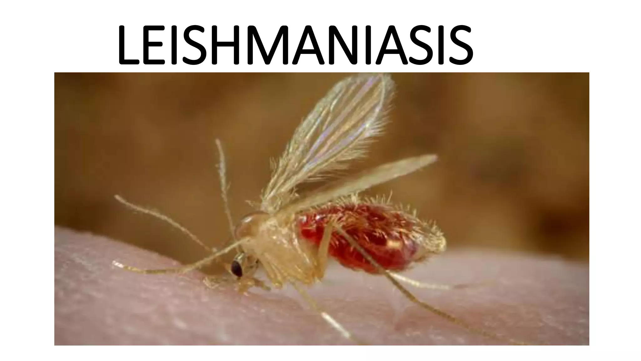 LEISHMANIASIS.pptx