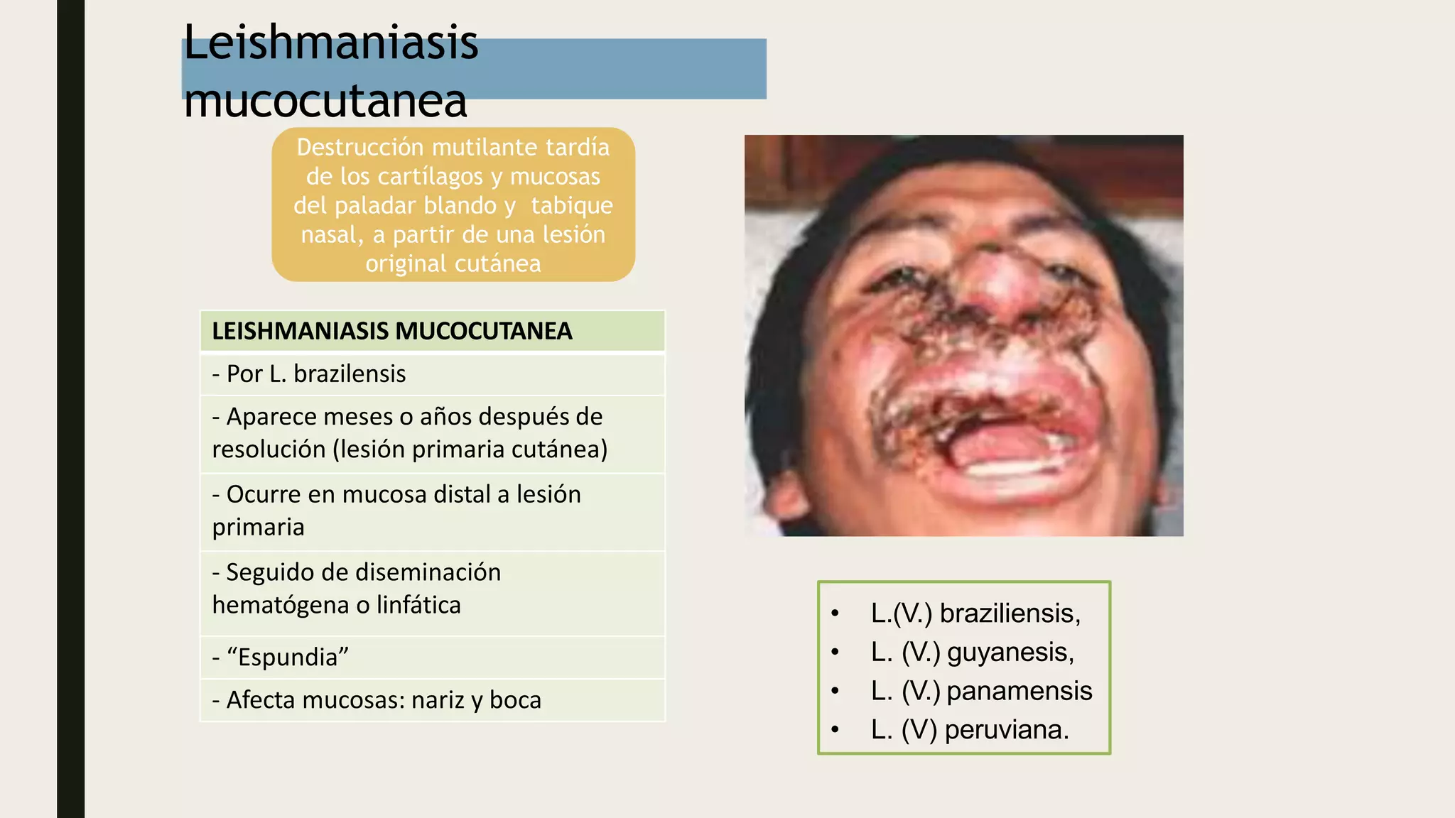 Leishmaniasis.pptx