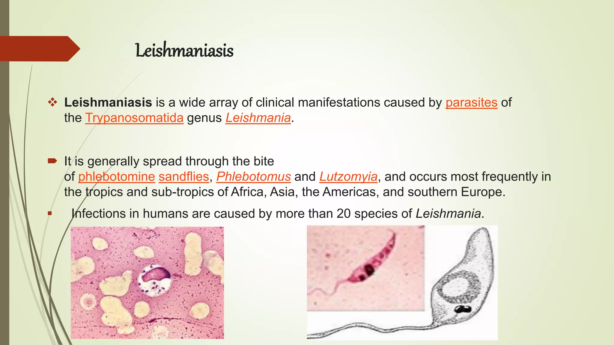 Leishmaniasis.pptx