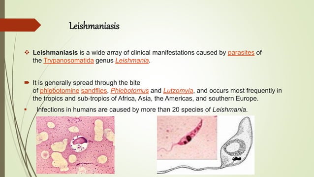 Leishmaniasis.pptx