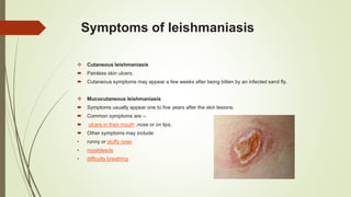 Leishmaniasis.pptx