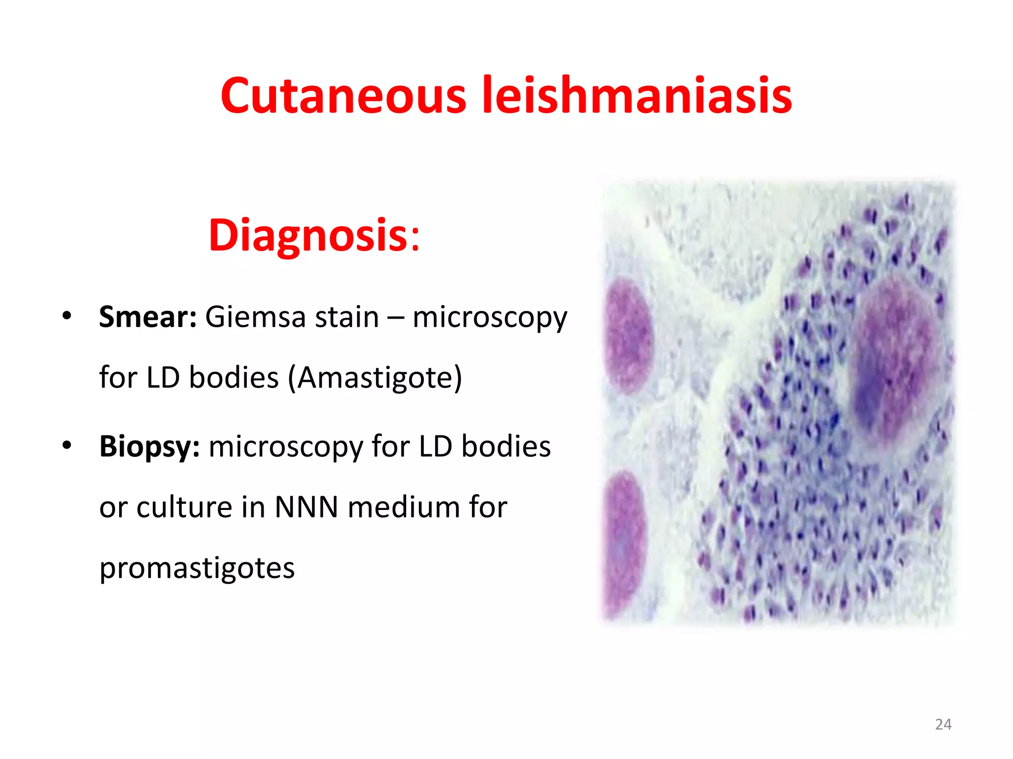 Leishmaniasis.pptx