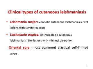 Leishmaniasis.pptx