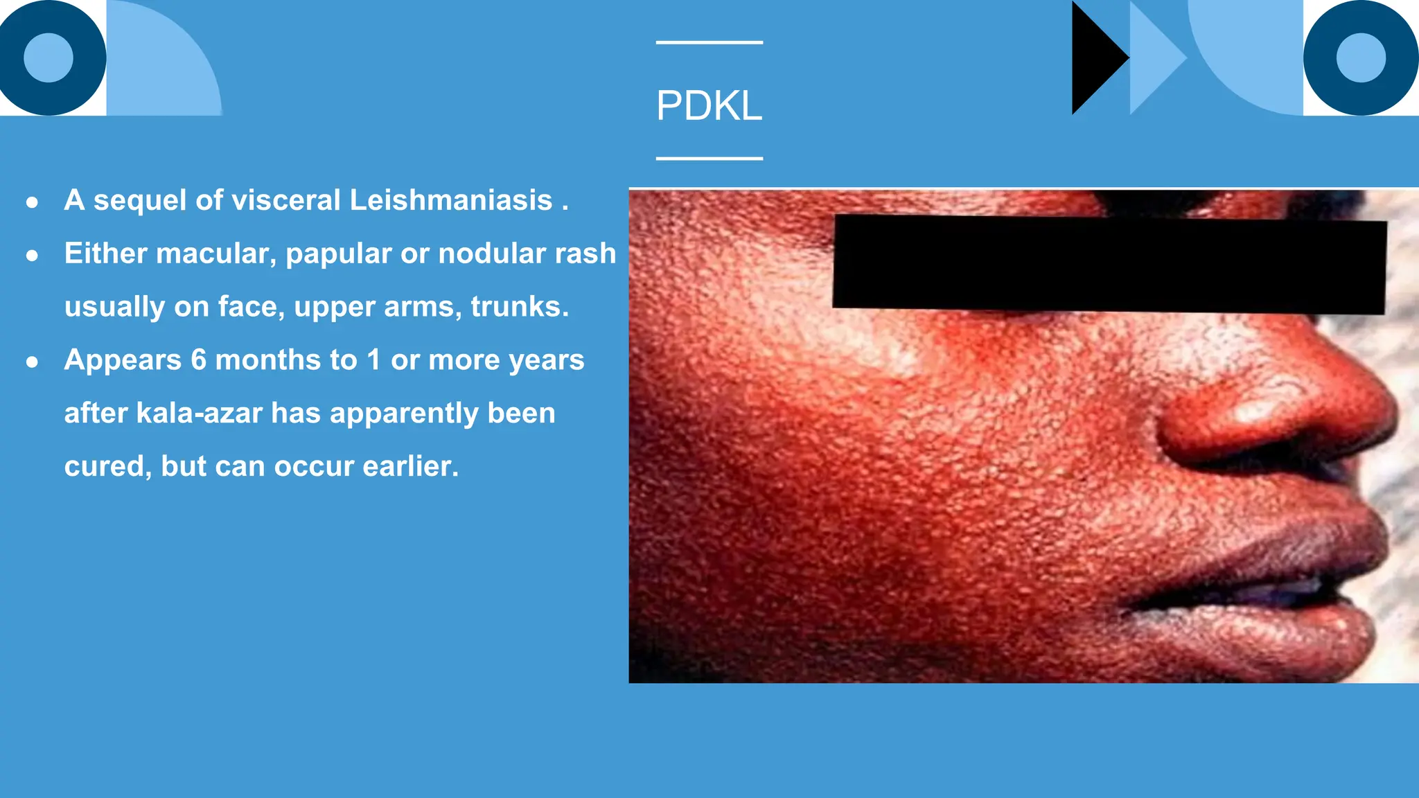 Leishmaniasis ( presentation in Africa). | PPT