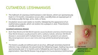 leishmania Donovani a hidden disease description .pptx