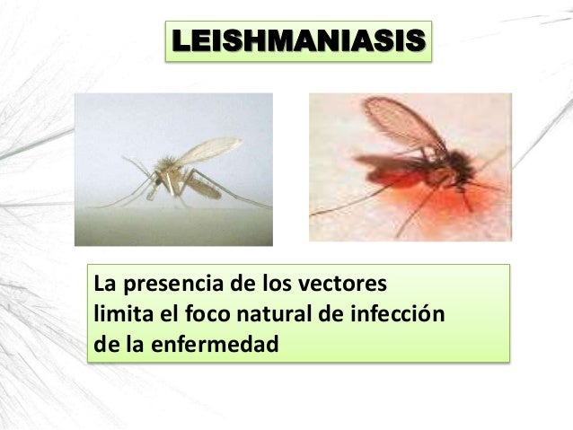 Leishmaniasis