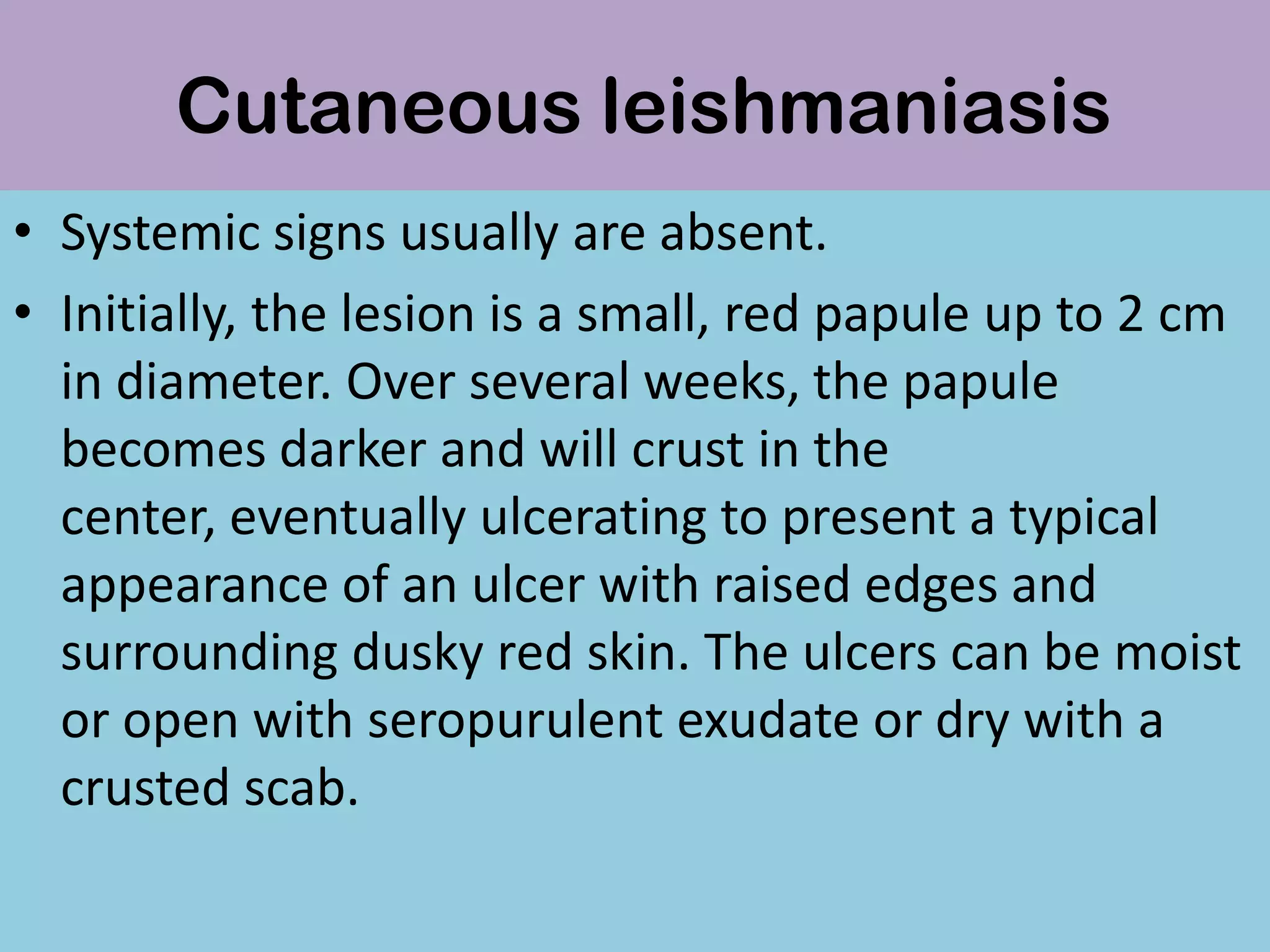 Leishmaniasis | PPTX