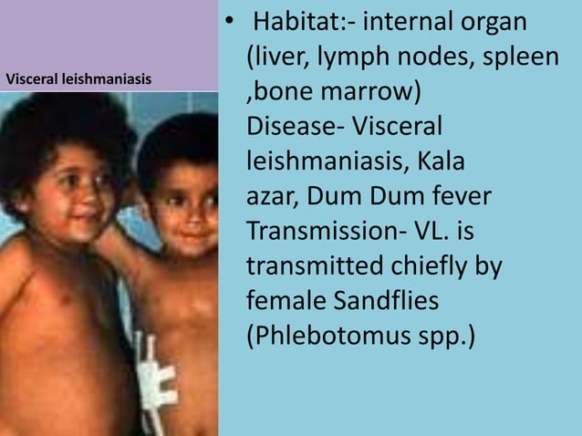 Leishmaniasis | PPTX | Infectious Diseases | Diseases and Conditions