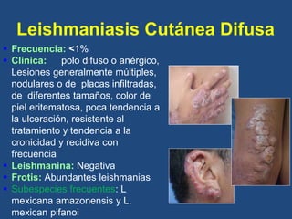 Leishmaniasis tegumentaria | PPTX