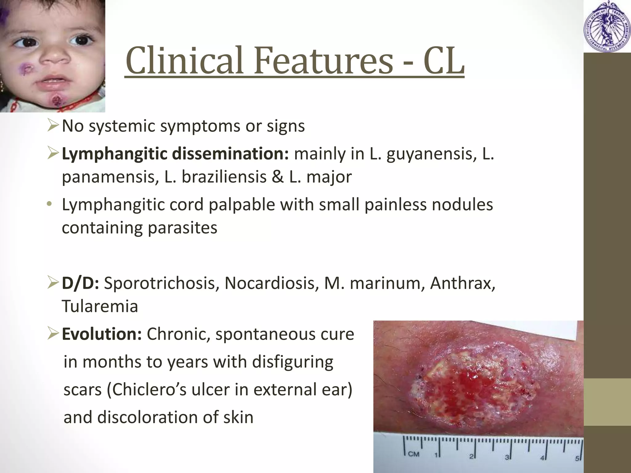 Current Strategies in Diagnosis & Treatment of Leishmaniasis | PPTX