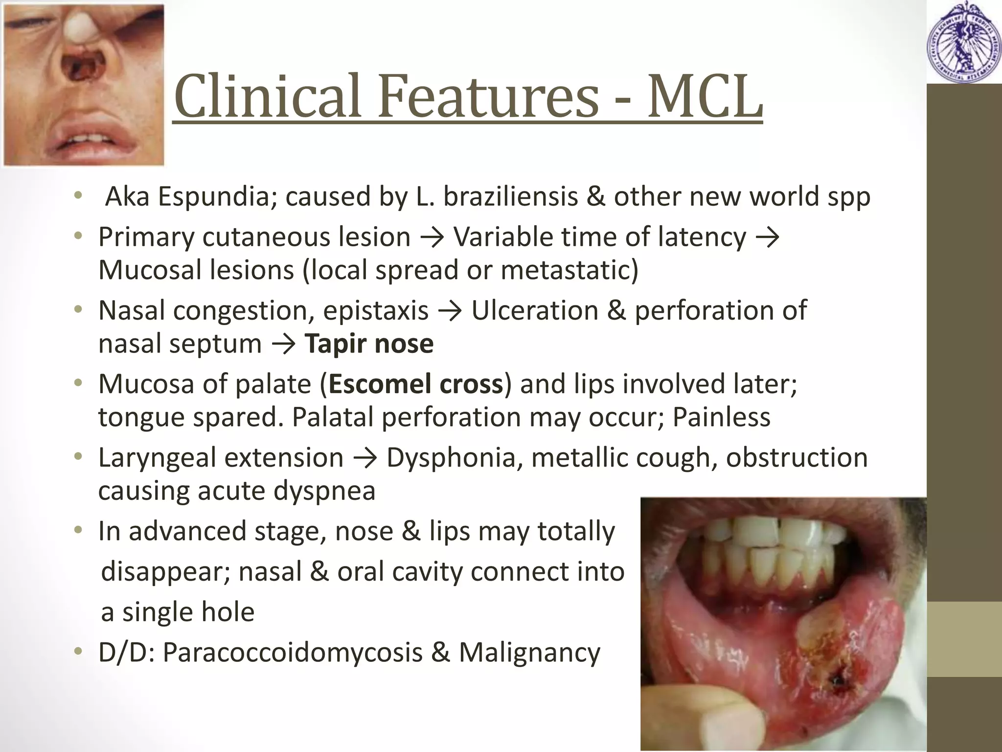 Current Strategies in Diagnosis & Treatment of Leishmaniasis | PPTX