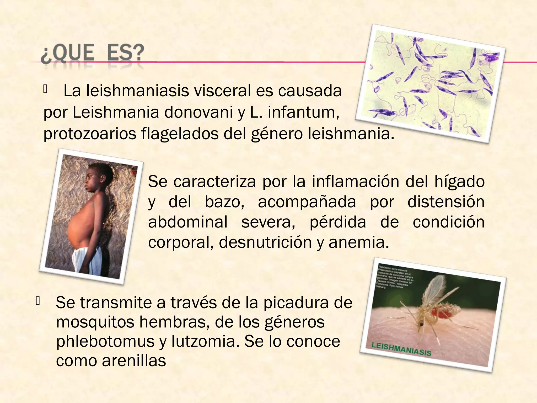 Leishmaniasis visceral humana | PPT | Infectious Diseases | Diseases ...