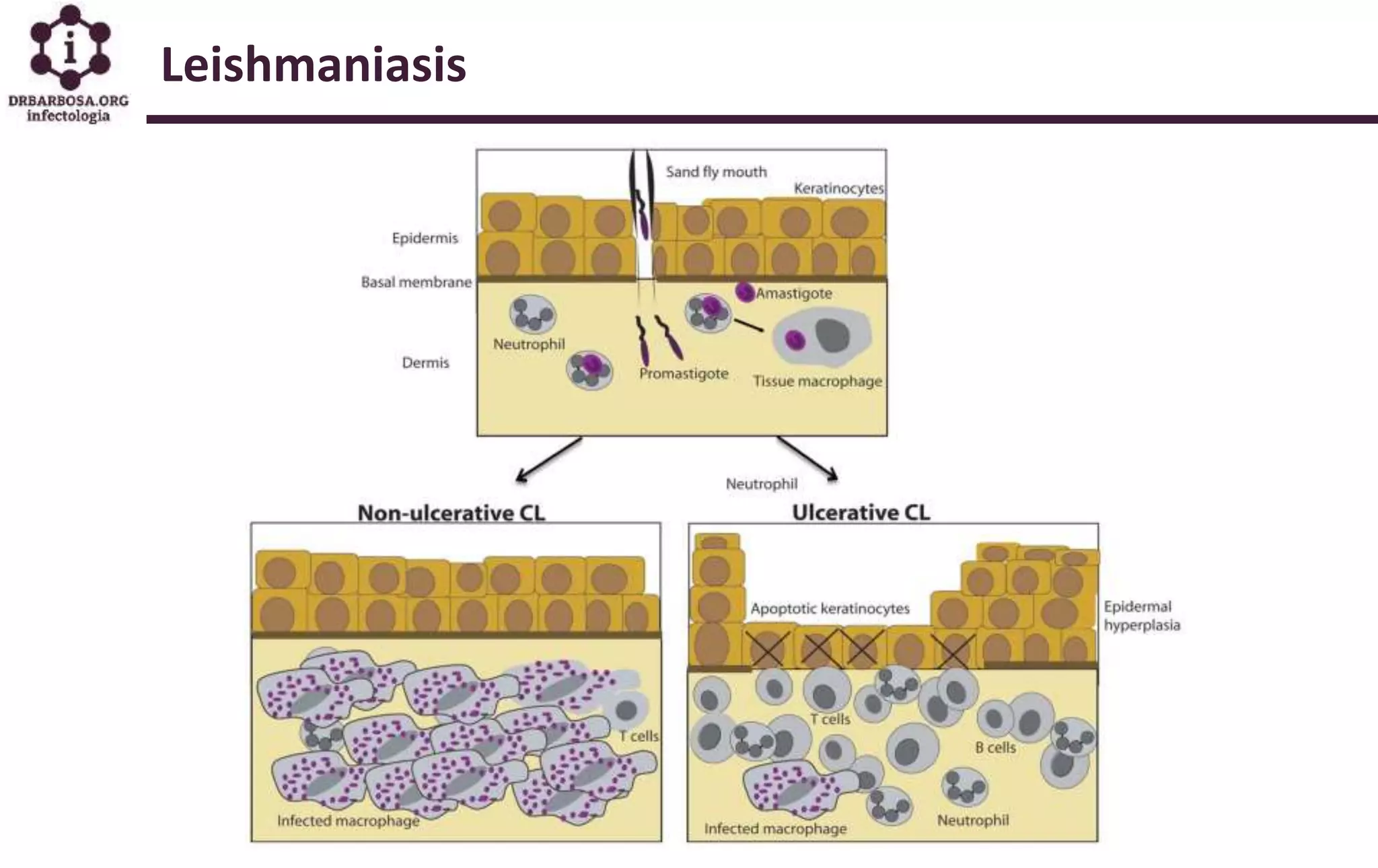 Leishmaniasis winter school tropical diseases unesp alexandre barbosa ...