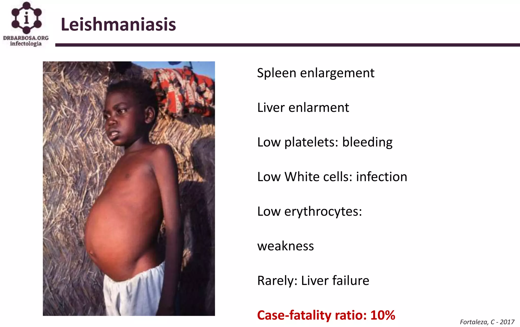 Leishmaniasis winter school tropical diseases unesp alexandre barbosa 2018 | PPTX | Infectious ...