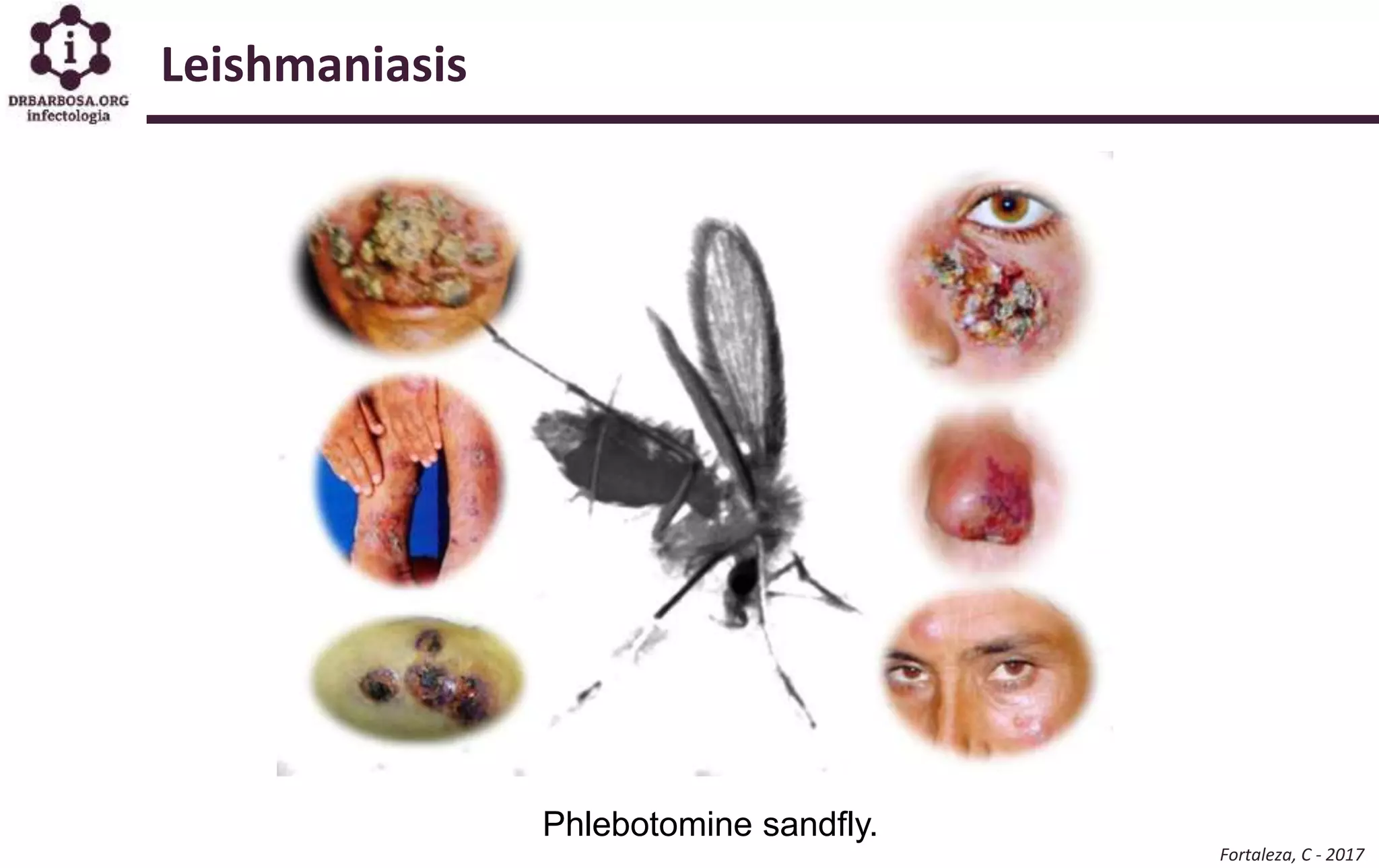 Leishmaniasis winter school tropical diseases unesp alexandre barbosa 2018 | PPT