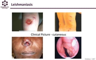 Leishmaniasis winter school tropical diseases unesp alexandre barbosa 2018 | PPTX | Infectious ...