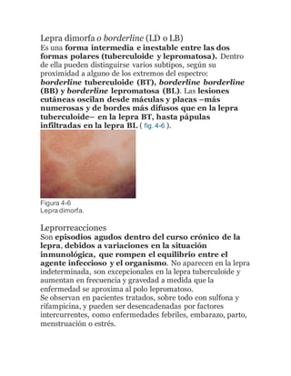 Leishmaniasis y lepra resumen | DOCX