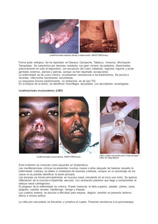 Leishmaniosis | DOCX