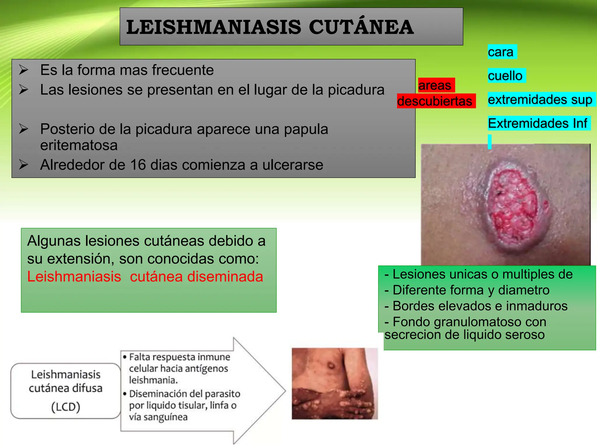 leishmniasis y sus complicacoiones en bolivia | PPTX