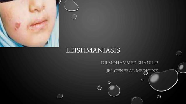 Leishmaniasis | PPT
