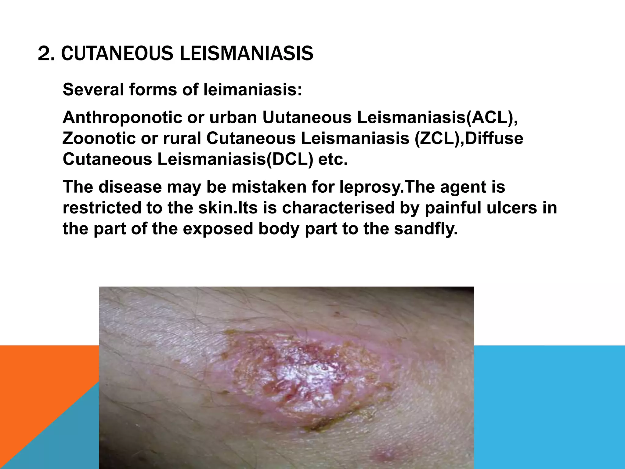 Leishmaniasis | PPTX