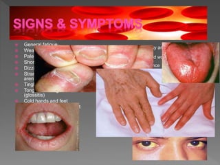 Iron Deficiency | PPT