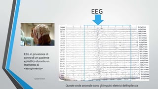 L'epilessia | PPTX