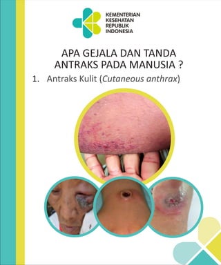 Lembar Balik ttg penyakit Antraks 2021.pdf