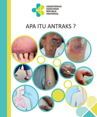 Lembar Balik ttg penyakit Antraks 2021.pdf