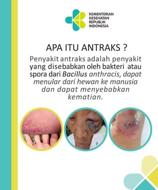 Lembar Balik ttg penyakit Antraks 2021.pdf