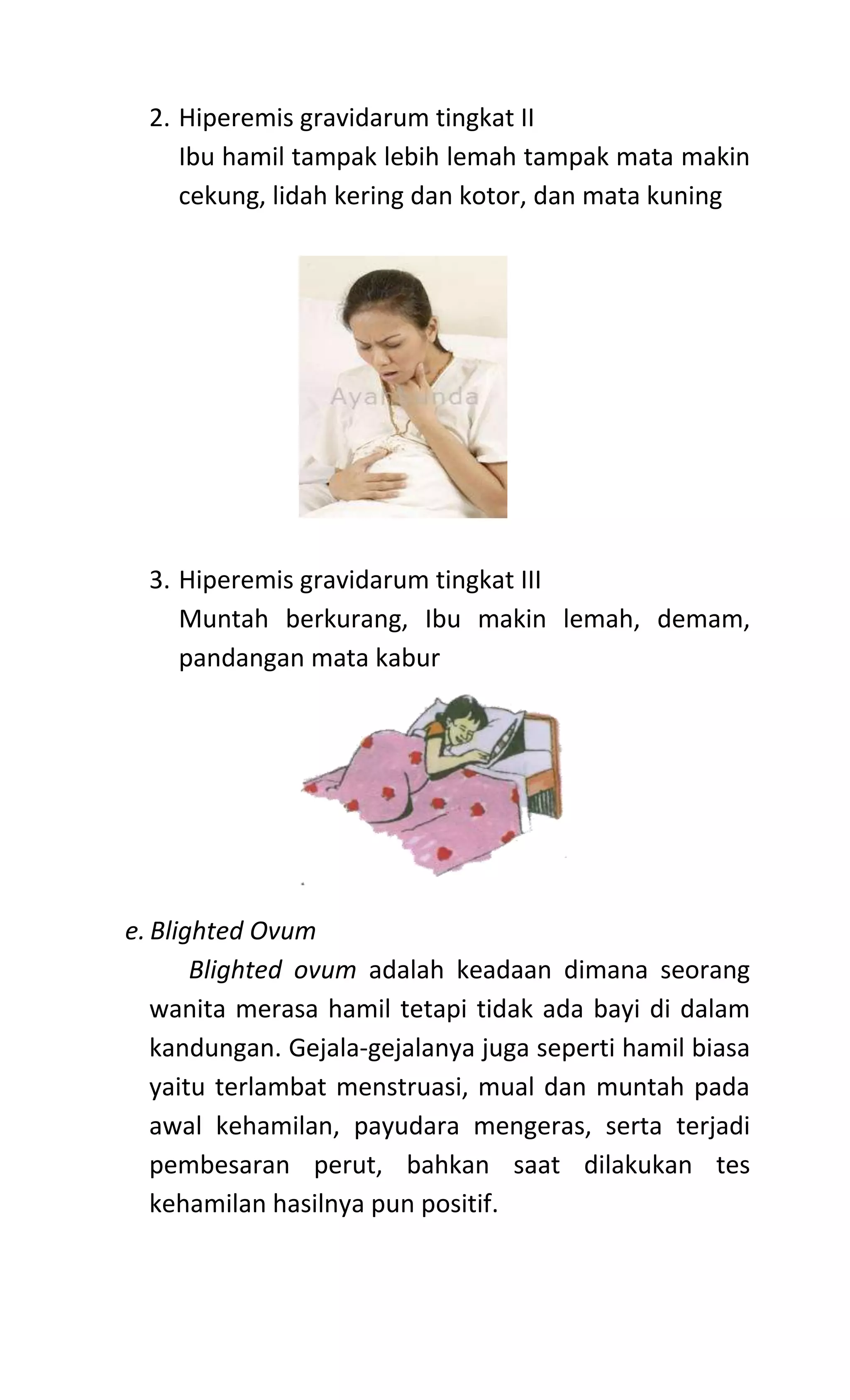 Lembar balik mater | DOCX