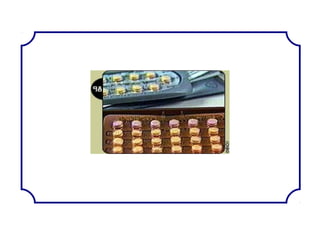 Lembar balik minipil 2 | PPT