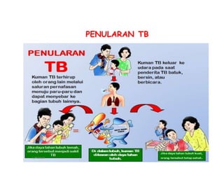 Lembar Balik TB Paru | DOCX