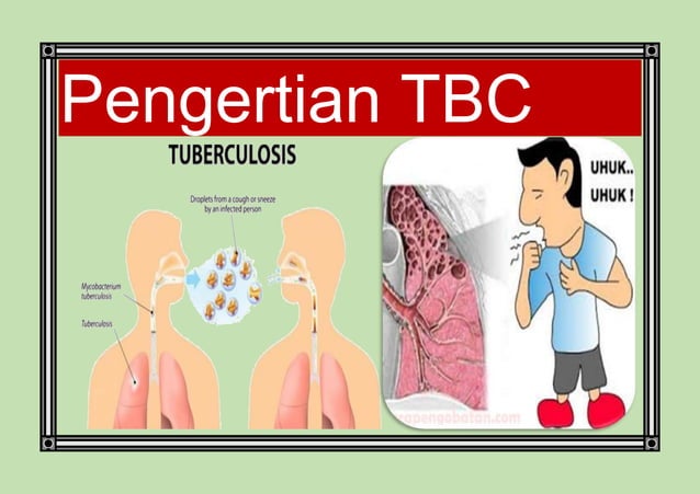 LEMBAR_BALIK_Tuberculosis_tbc_docx.docx | Free Download