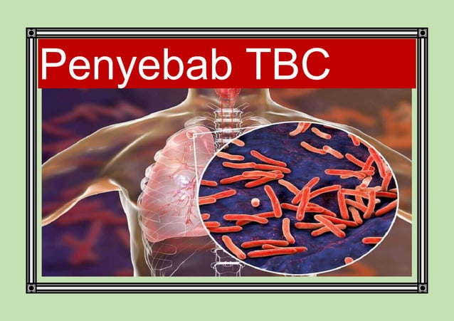 LEMBAR_BALIK_Tuberculosis_tbc_docx.docx
