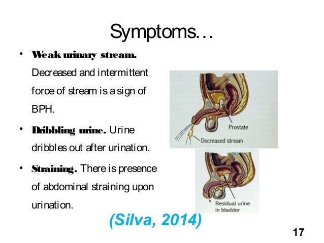 Lemessa Jira BPH slide share