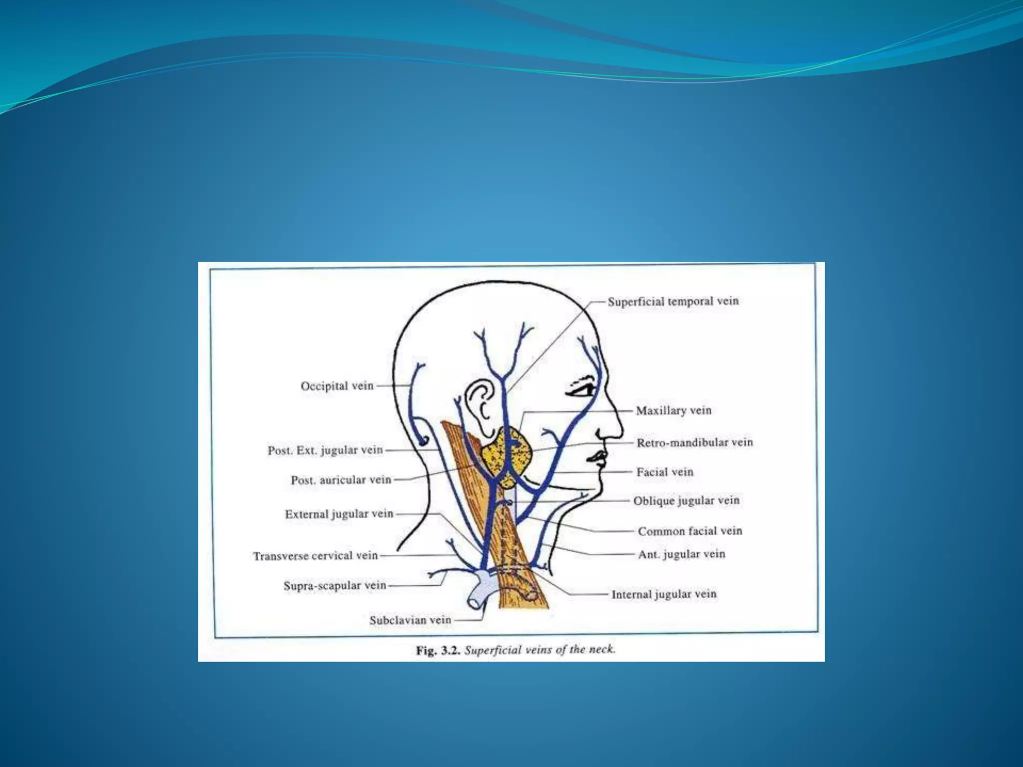 Lemierre syndrome | PPTX
