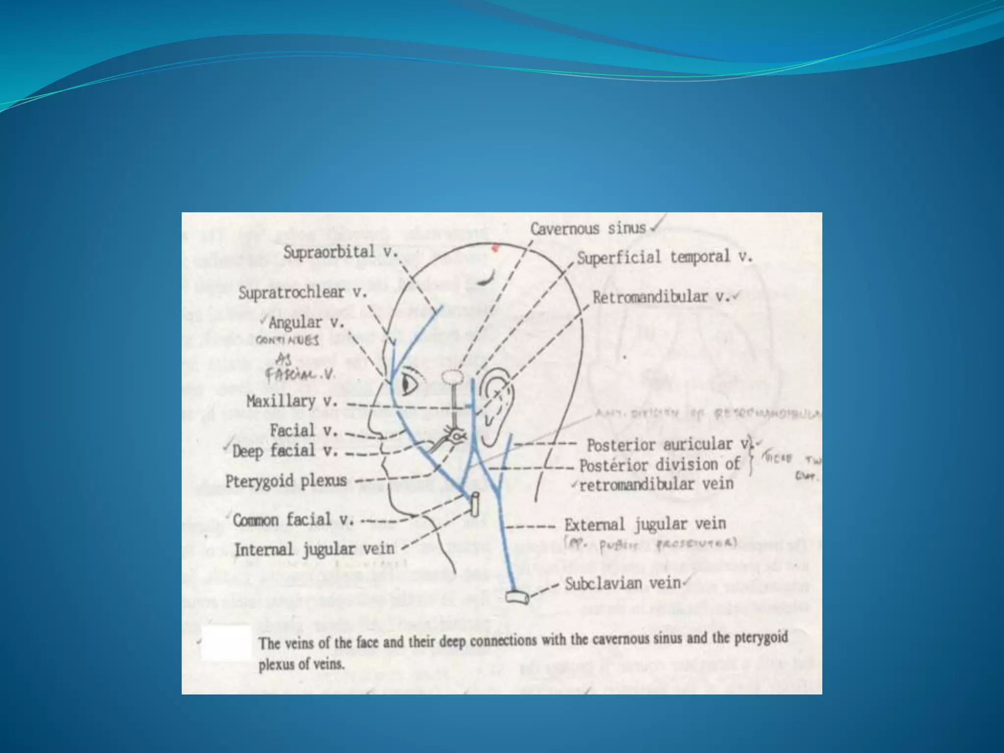 Lemierre syndrome | PPTX