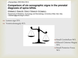 Lemon and Banana signs | PPT