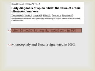 Lemon and Banana signs | PPT