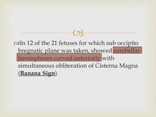 Lemon and Banana signs | PPT
