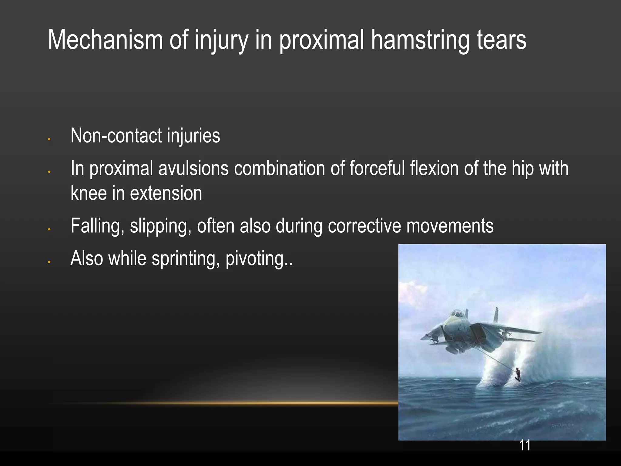 Lasse Lempainen - Hamstring injuries: When is surgery indicated? | PPT