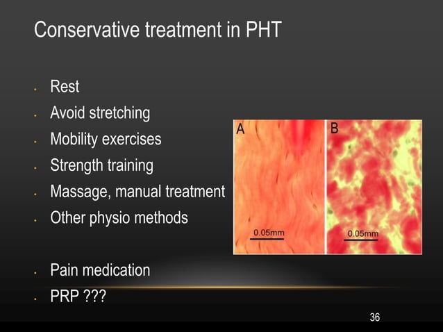 Lasse Lempainen - Hamstring injuries: When is surgery indicated? | PPT
