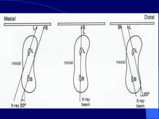 LENGTH DETERMINATION.ppt