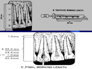 LENGTH DETERMINATION.ppt