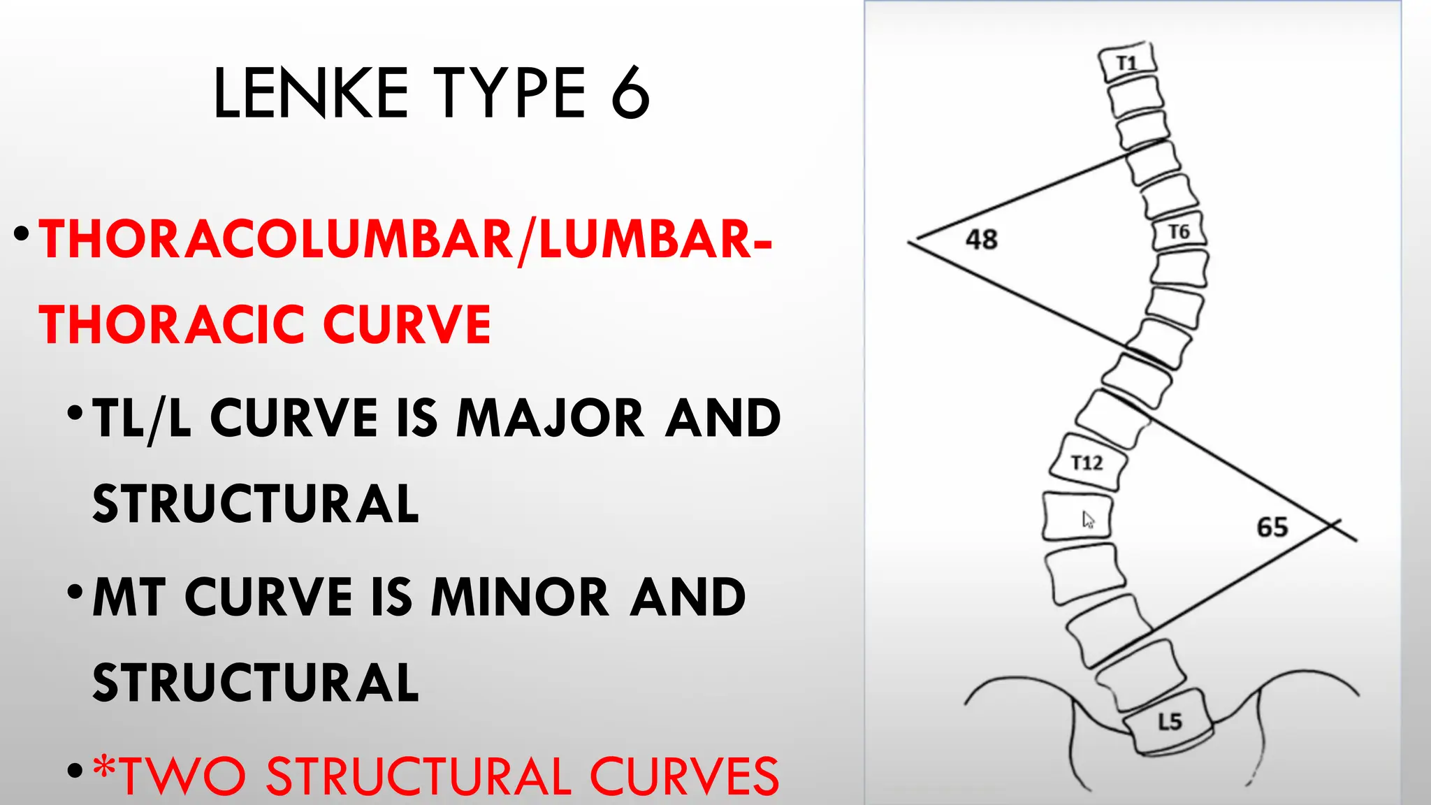 Lenke Classification for Adolescent Idiopathic Scoliosis (AIS) | PPT