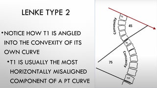 Lenke Classification for Adolescent Idiopathic Scoliosis (AIS) | PPT
