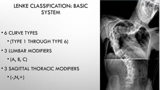 Lenke Classification for Adolescent Idiopathic Scoliosis (AIS) | PPT